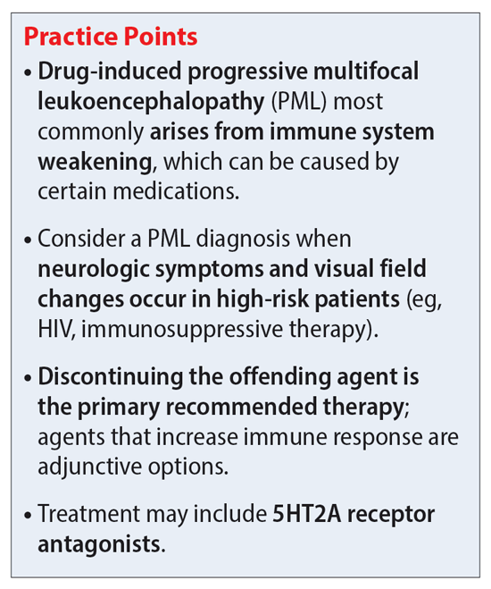 Drug induced Progressive Multifocal Leukoencephalopathy Rare But 