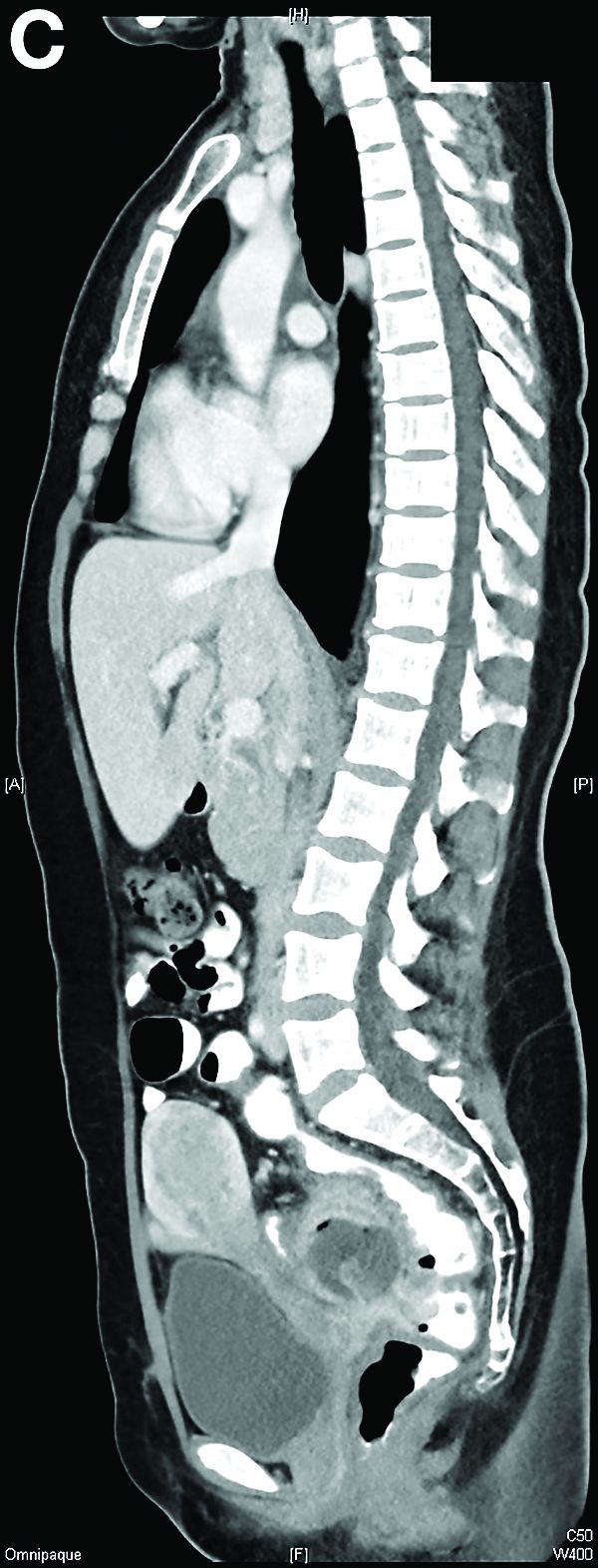 August 2018 - What's your diagnosis? | GI and Hepatology News