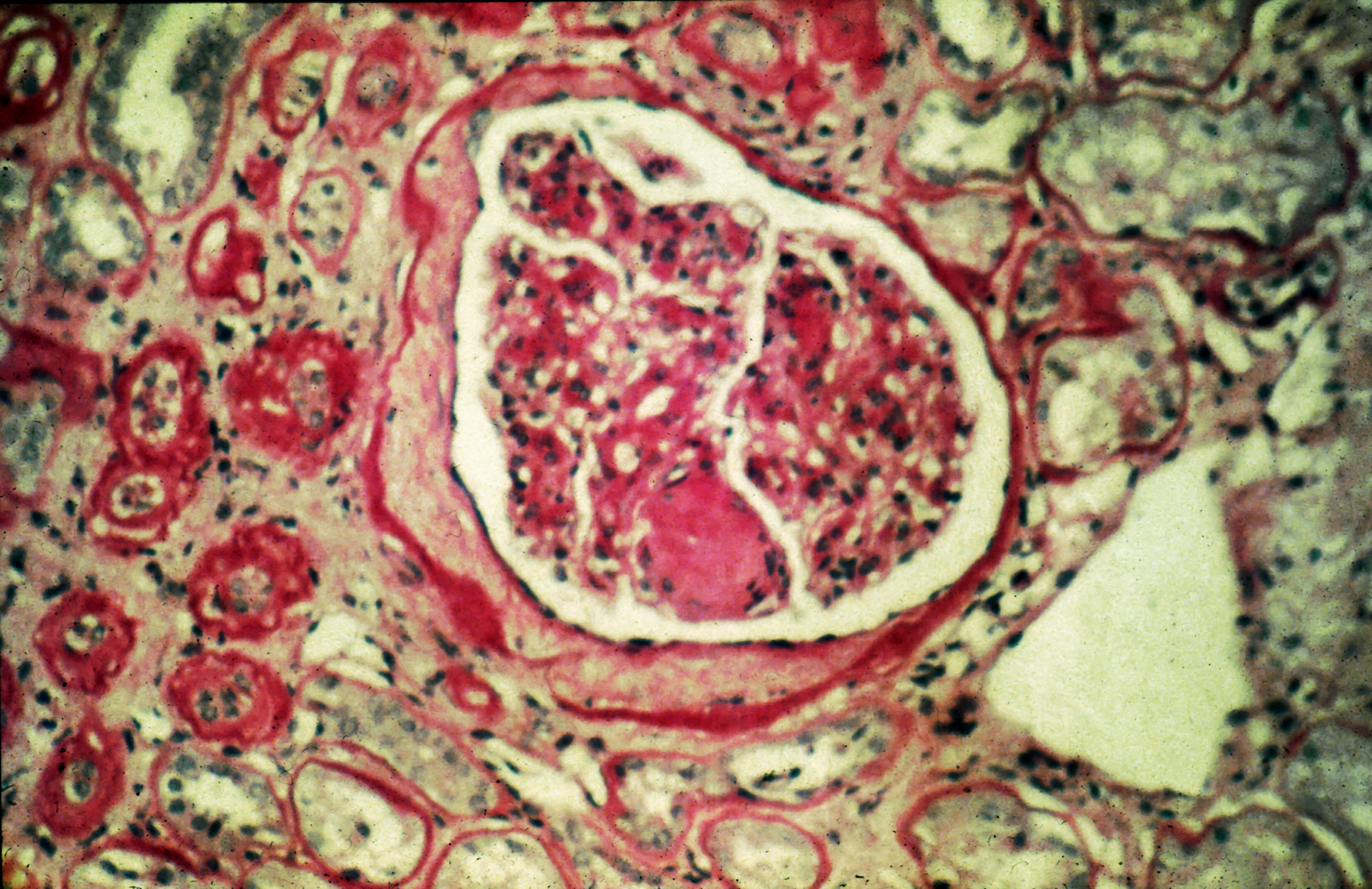 Pruritus and swelling | MDedge