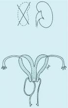 Introitus Female Anatomy