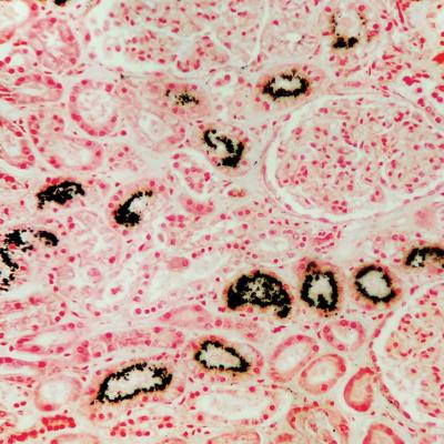 Lithium-associated hypercalcemia: Monitoring and management | MDedge ...