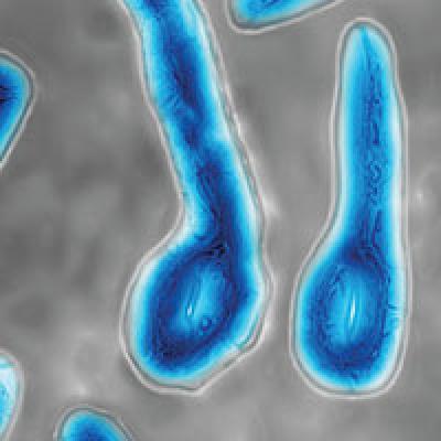 Tetanus: Debilitating Infection | Clinician Reviews