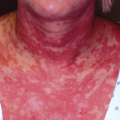 How I Became a Derm Guru (And How You Can, Too) | Clinician Reviews