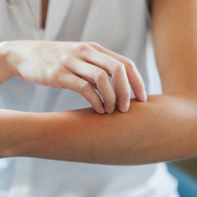 Quantifying Itch: Measurement on the Way to Management | MDedge Dermatology