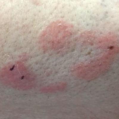 Make The Diagnosis - September 2018 | MDedge Hematology and Oncology