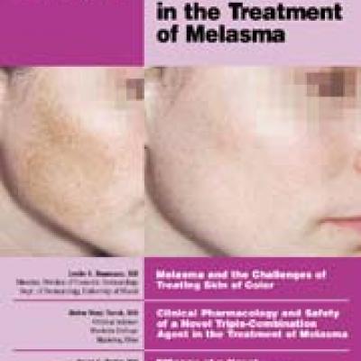 New Directions in the Treatment of Melasma | MDedge Dermatology