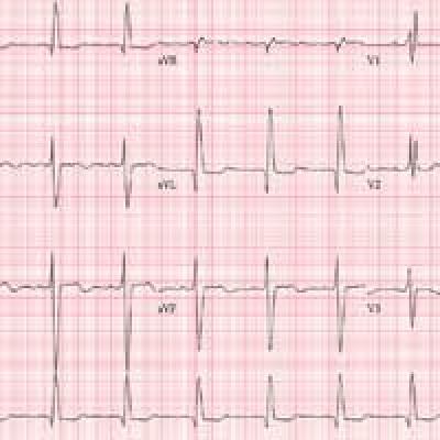 This Evaluation Is a Heart-stopper | Clinician Reviews