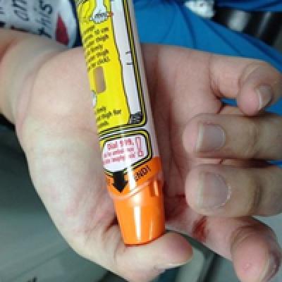 Digital Ischemia From Accidental Epinephrine Injection | MDedge ...