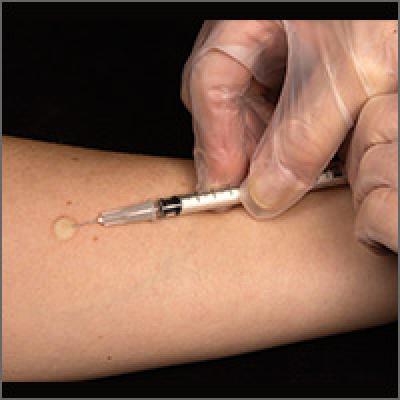 Screening for tuberculosis: Updated recommendations | MDedge Family ...