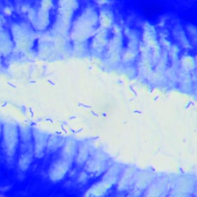 Giemsa Stain Helicobacter Pylori