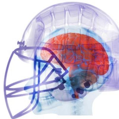 Clinical Management of Sports-Related Pediatric Concussions | Clinician ...