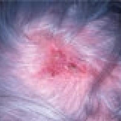 Kerion Mimicking Erosive Pustular Dermatosis in Elderly Patients | MDedge Dermatology