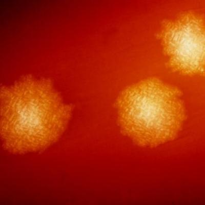 New HAI reduction targets proposed | MDedge