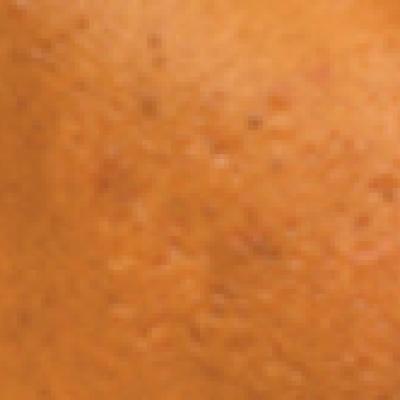 Treating Acne Scars in Patients With Fitzpatrick Skin Types IV to VI ...