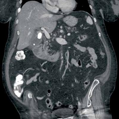 Epigastric abdominal pain | MDedge Emergency Medicine