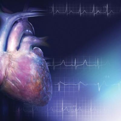 4 EKG abnormalities: What are the lifesaving diagnoses? | MDedge Family ...
