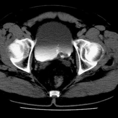 Dysuria | MDedge Family Medicine