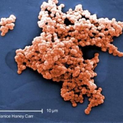 Excessive GBS sepsis evaluations of neonates curbed | MDedge ObGyn