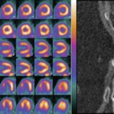 Comparing imaging technologies for chest pain in ED | MDedge Cardiology