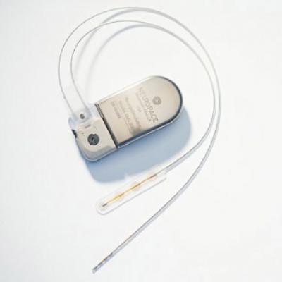 Cortical stimulation device provides safe, sustained seizure reduction ...