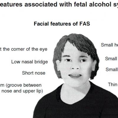 How to screen for, manage FASD in a medical home | MDedge ObGyn