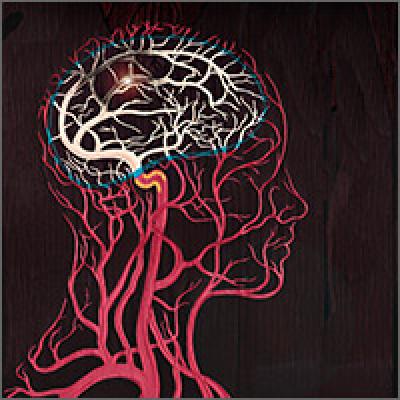 Stroke: A road map for subacute management | MDedge Family Medicine