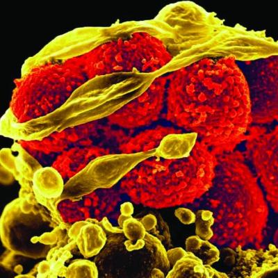 Understanding SSTI admission, treatment crucial to reducing disease ...