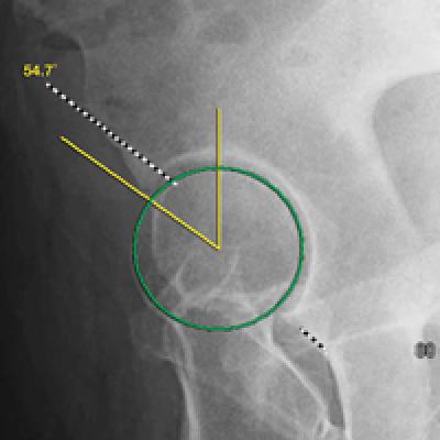 Imaging for Nonarthritic Hip Pathology | MDedge Surgery