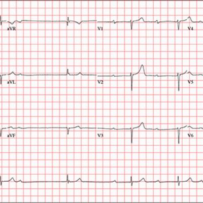 A Double Dose of Trouble | Clinician Reviews