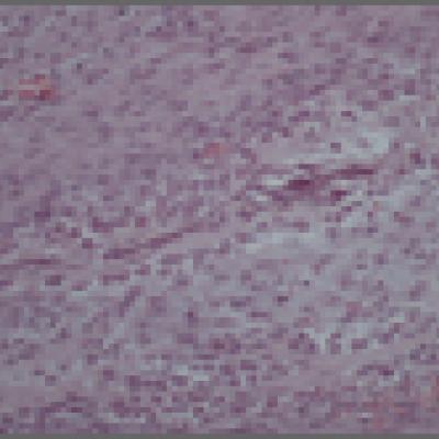 Factors Affecting Bone Growth | MDedge Surgery