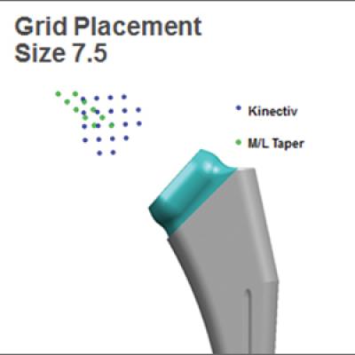 Modular Versus Nonmodular Femoral Necks for Primary Total Hip ...