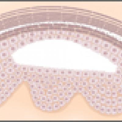 Hand Blisters in Major League Baseball Pitchers: Current Concepts and ...