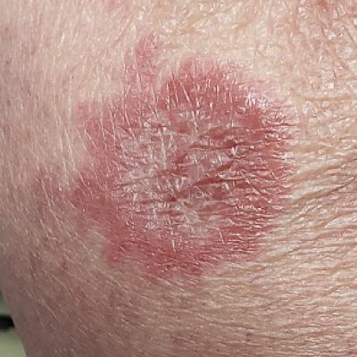 Making the Rounds to Diagnosis | Clinician Reviews