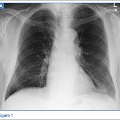 Emergency Imaging: Presyncopal episode | MDedge Emergency Medicine