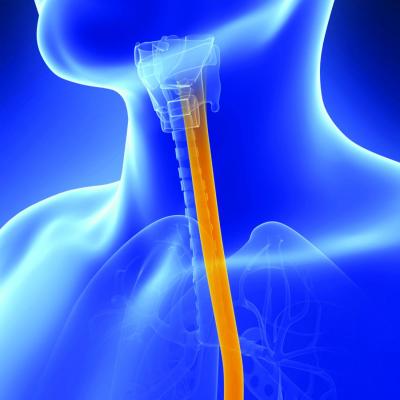 Barrett’s esophagus: AGA screening update ‘goes above and beyond ...
