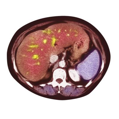 Pain in upper right abdomen | Obesity Challenge Center