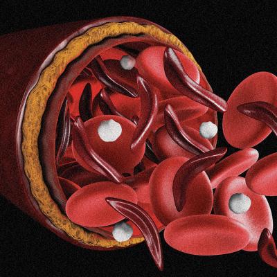 Health Care Disparities Among Adolescents and Adults With Sickle Cell ...