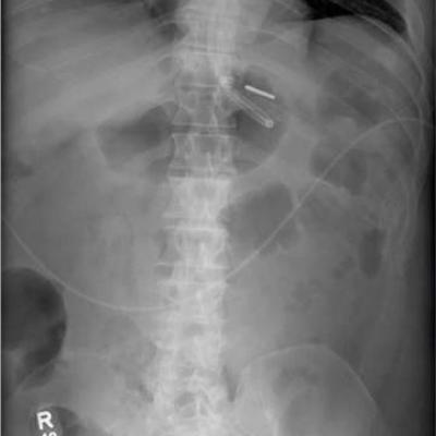 Altered Mental Status Demands Closer Look | Clinician Reviews