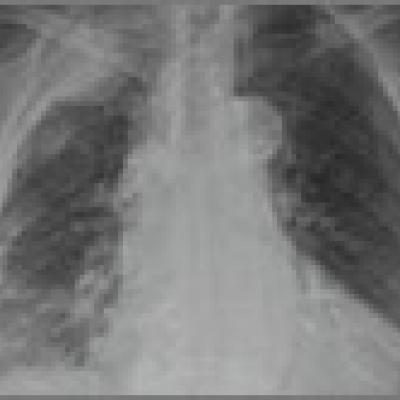 Elderly woman with sharp shoulder pain | MDedge Family Medicine