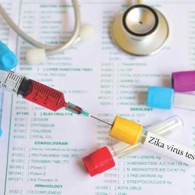 CDC updates guidelines for Zika virus testing, interpretation of ...