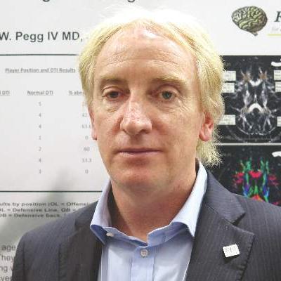 Scans show high prevalence of TBI among symptomatic retired NFL players ...