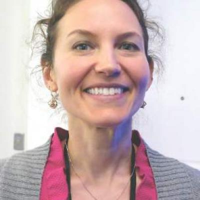 Tips on how to differentiate CLE from dermatomyositis | MDedge Rheumatology