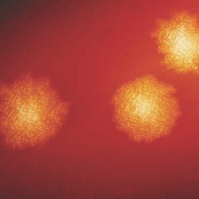 Isolating asymptomatic C. diff carriers slashes hospital-acquired ...
