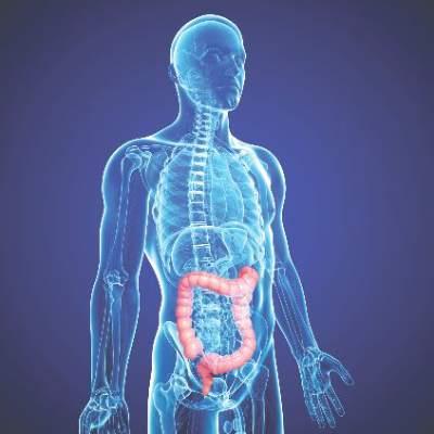 Outcomes of stage III colon cancer appear better for aspirin, COX-2 ...
