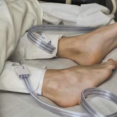 IPC maintains first-line status in preventing DVT in most surgical ...