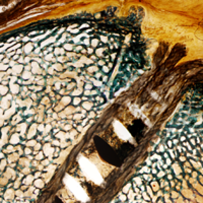 Use of a Novel Magnesium-Based Resorbable Bone Cement for Augmenting ...