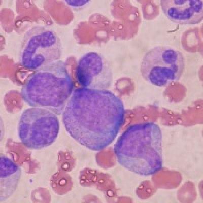 Method may improve HSC mobilization, engraftment | MDedge Hematology ...