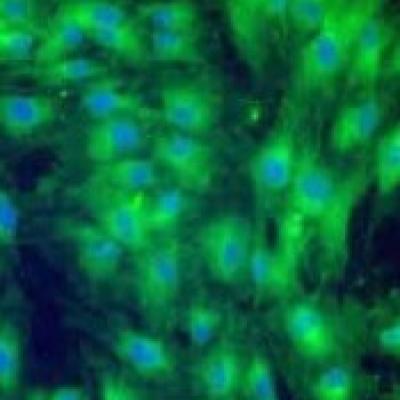 Team explains how MM cells alter BM to thrive | MDedge Hematology and ...