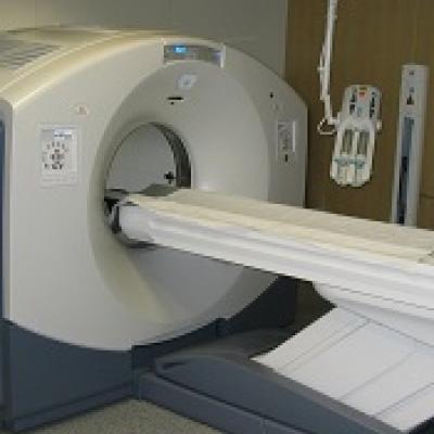 New radiation guidelines for pediatric HL | MDedge Hematology and Oncology