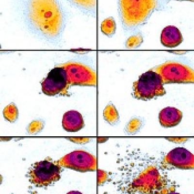 Newfound mechanism could be used to fight cancers | MDedge Hematology ...